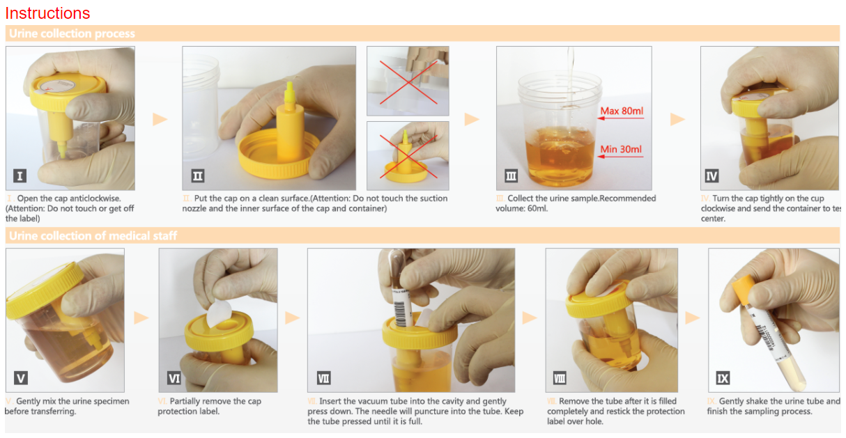 Vacuum Urine Collector